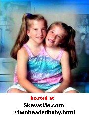 Two-Headed Baby - Skews.Me